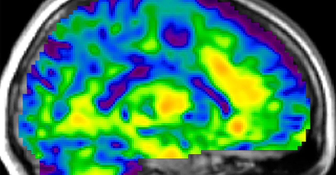 Open Source @ Mechanical Neuroimaging Laboratory - Page 2